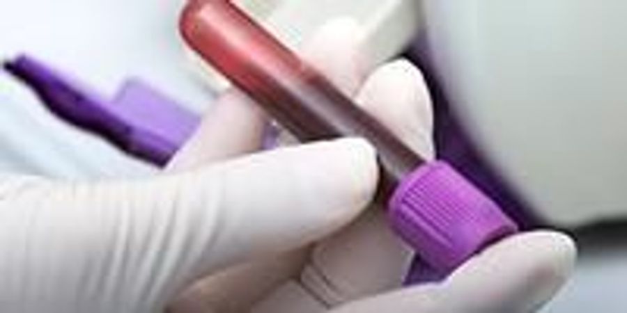 New Gene-Based Blood Tests Identify More Skin Cancers | Lab Manager