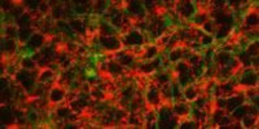 Fish Eyes May Hold Key to Regenerating Human Retinas | Lab Manager