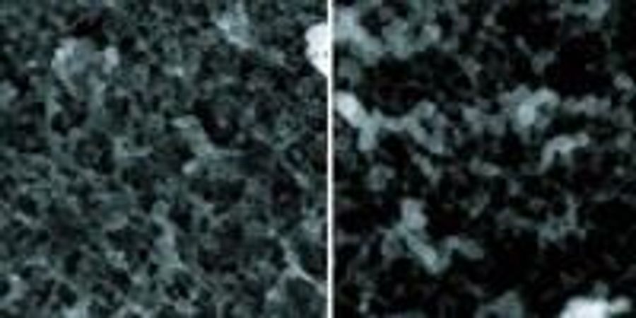 Food Additive Found in Candy, Gum Could Alter Digestive Cell Structure ...