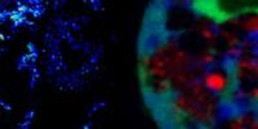 Organo-Metal Compound Seen Killing Cancer Cells from Inside | Lab Manager