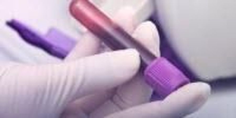 Study Finds Troubling Inconsistency in Dialysis Blood Testing Methods ...