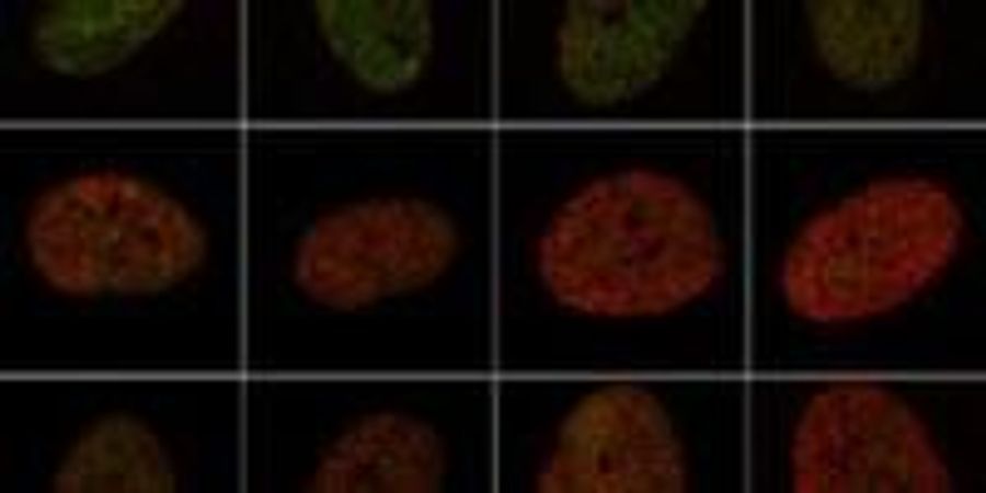 Super-Resolution Imaging Offers Fast Way to Discern Fate of Stem Cells ...