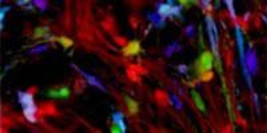 First Cell Culture of Live Adult Human Neurons Shows Potential of Brain ...