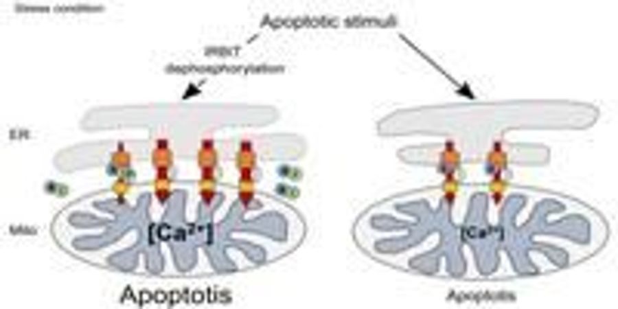 An 'IRBIT'uary before Cell Death | Lab Manager