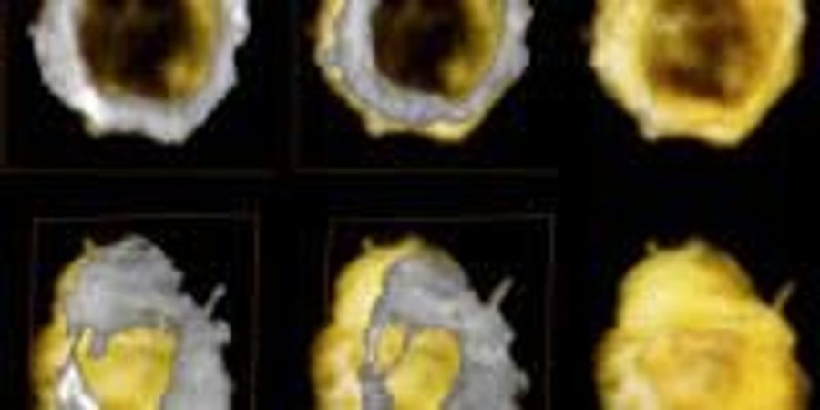 Scientists Track Chemical and Structural Evolution of Catalytic ...