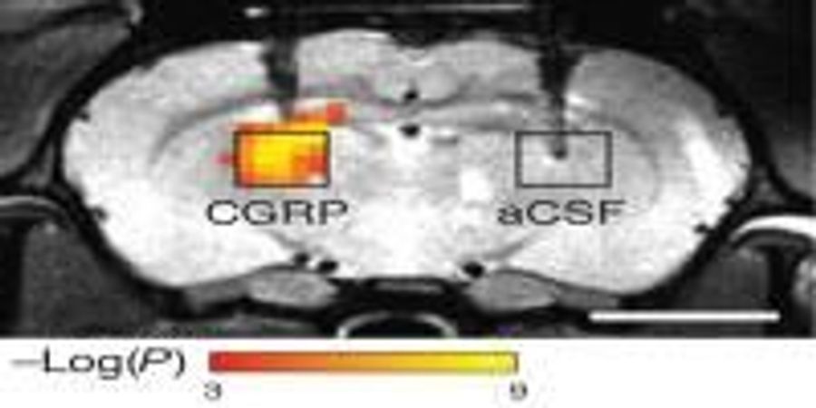 A Radiation-Free Approach to Imaging Molecules in the Brain | Lab Manager