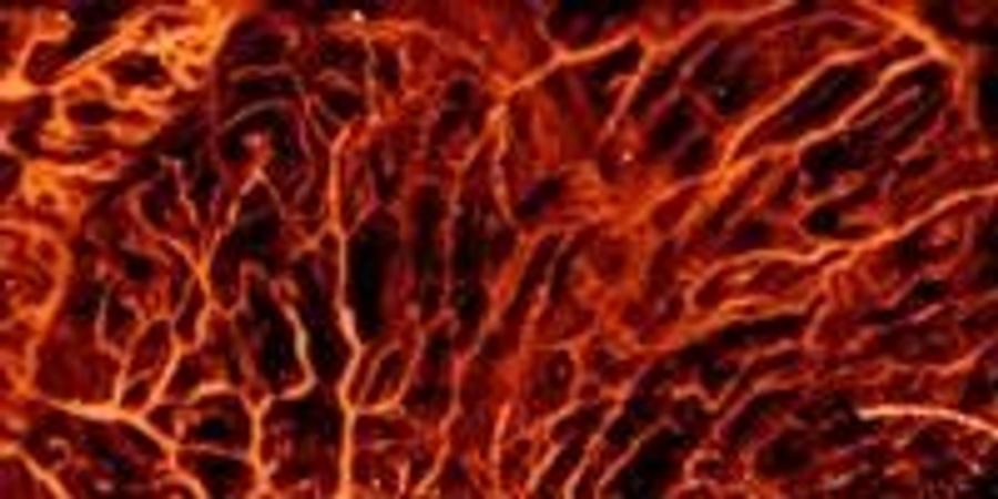 Artificial Intelligence Improves Biomedical Imaging | Lab Manager