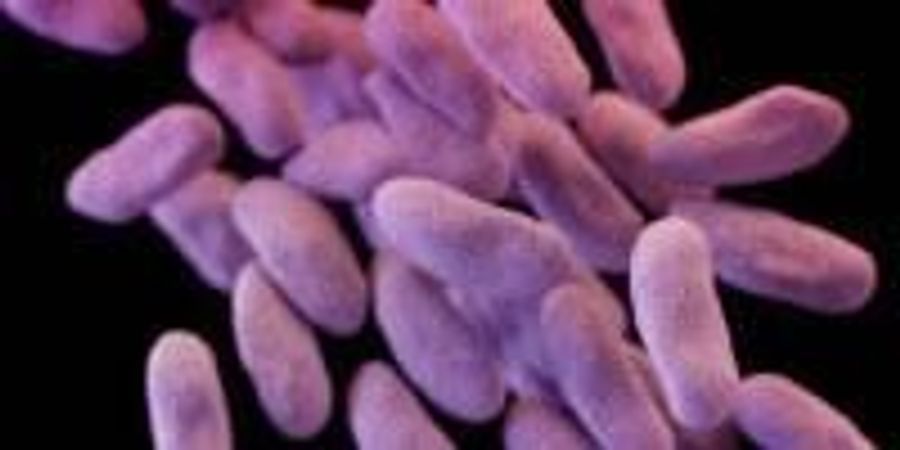 Research Project to Combat 'Superbugs,' Antibiotic Resistance | Lab Manager