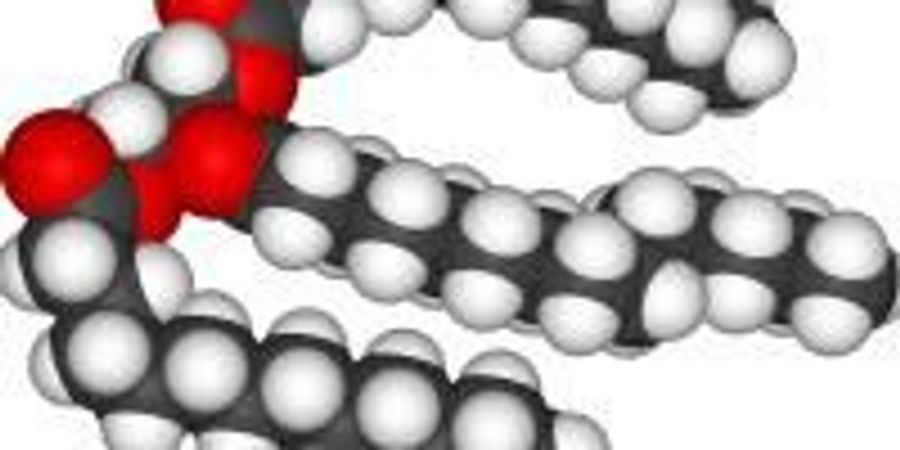 Shades of Fat: Why One Leads to Obesity and Another to Hibernation ...