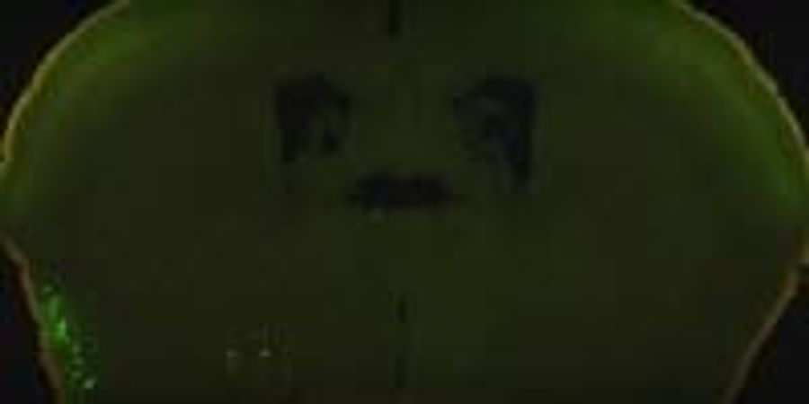 Revolutionary Method to Map the Brain at Single-Neuron Resolution Is ...