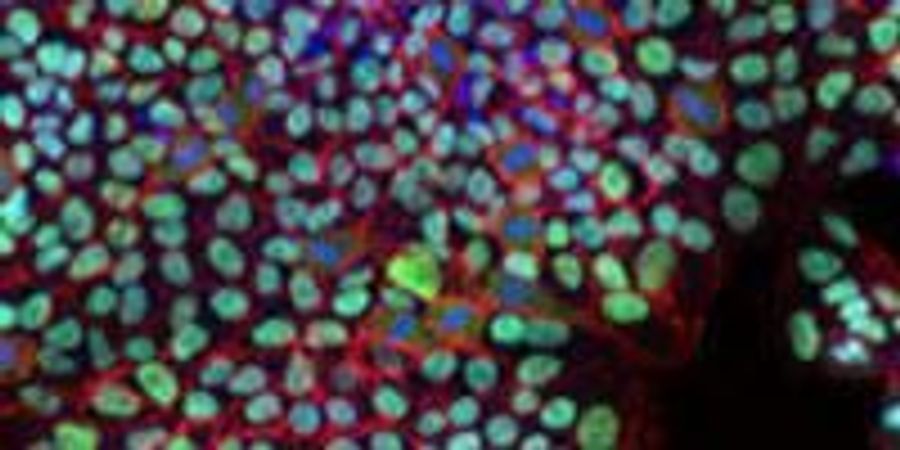 Breakthrough in Scaling up Life-Changing Stem Cell Production | Lab Manager