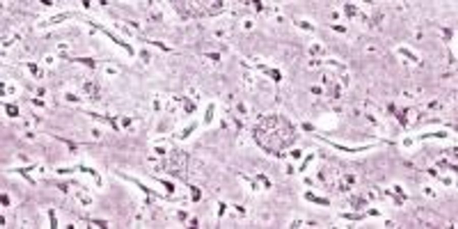 Genetically Engineered Mice Suggest New Model for How Alzheimer’s ...