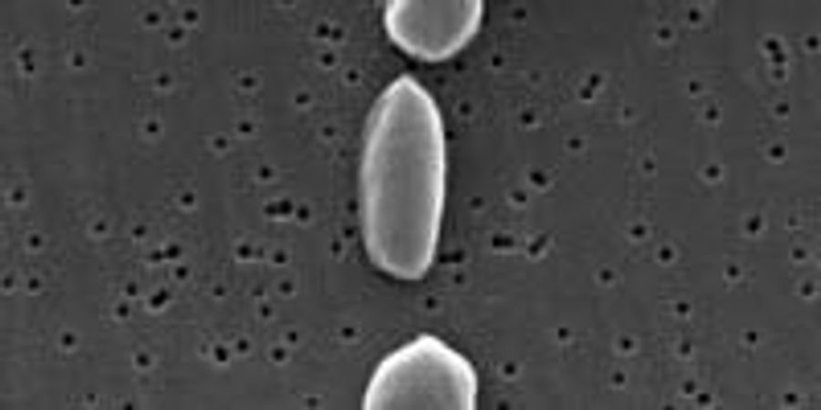 Study Finds Sensing Mechanism in Food Poisoning Bug | Lab Manager