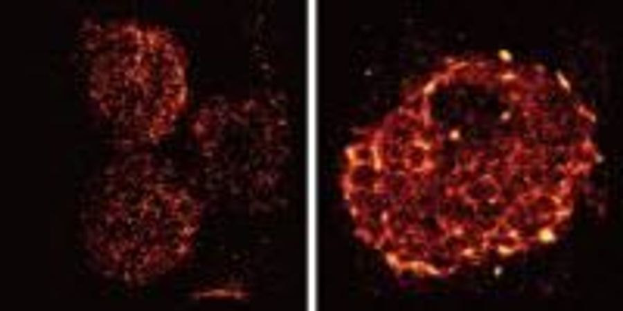 Super-Resolution Microscopy Reveals Unprecedented Detail of Immune ...