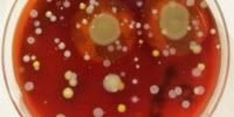 Yuck Factor May Boost Hand Hygiene Compliance | Lab Manager