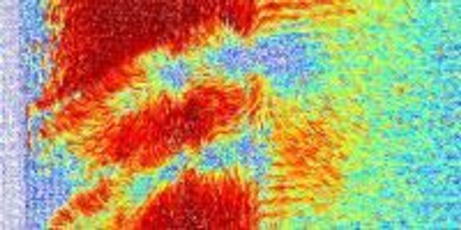 New High-Capability Solid-State Electron Microscope Detector Enables ...