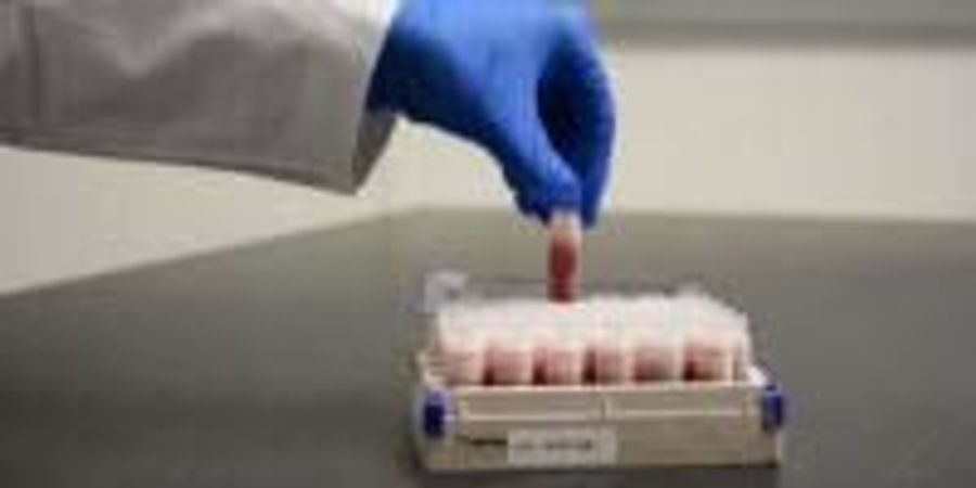 Scientists Find Genetic Cause of Multiple Sclerosis | Lab Manager