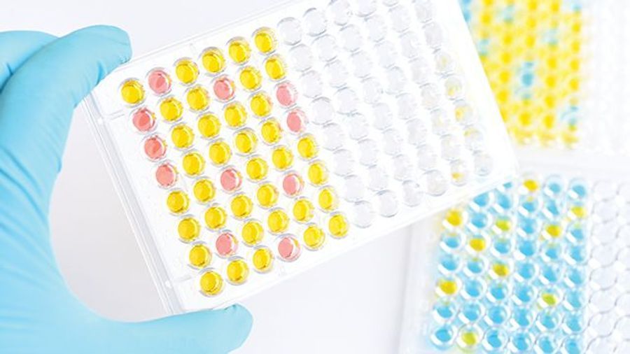 Assay Development: Vaccines | Lab Manager