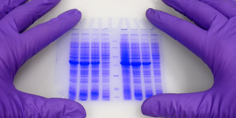 Capillary Electrophoresis vs Gel Electrophoresis: Comparing Separation ...