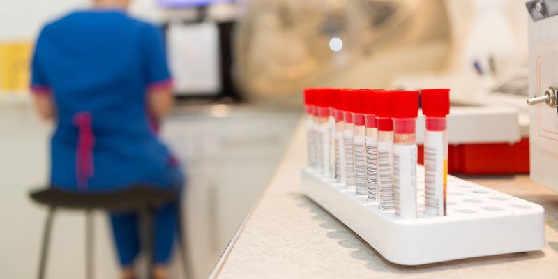 Run Toxic, Nutritional, and Implant Markers in a Single Urine Panel ...