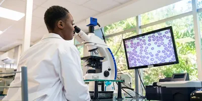 AI Image Analysis Helps Quantify Tumor Microenvironment Changes | Lab ...
